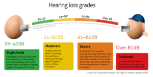 Understanding Hearing Loss | The Hearing Solution Group